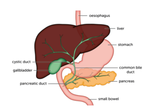 Bile duct cancer - Liver Cancer UK